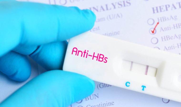 Anti HBS nedir? Anti HBS pozitif ne demek? - Son Haber Burda Güncel ... Anti HBS nedir? Anti HBS pozitif ne demek? - Son Haber Burda Güncel ...